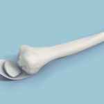 Allografts - Australian Allografts